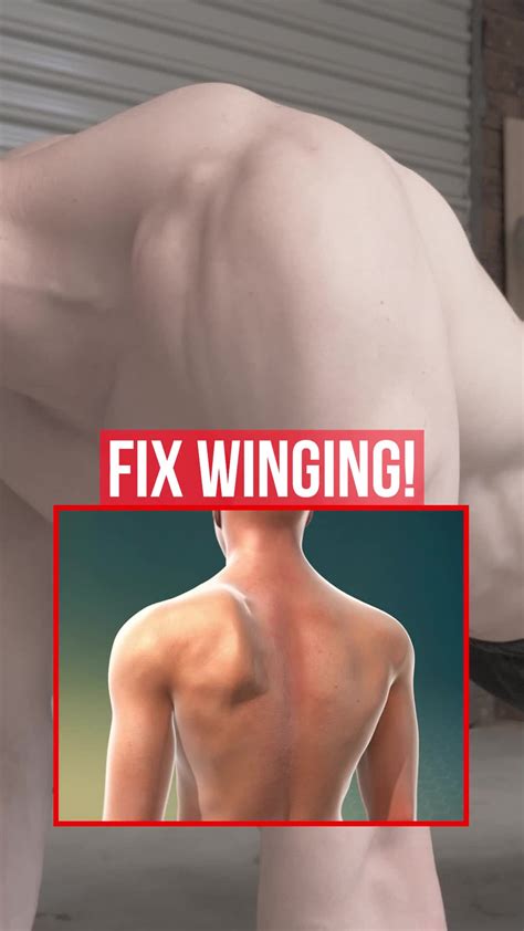 How To Fix Scapular Winging Scapular Dyskinesis Is Caused By Weakness