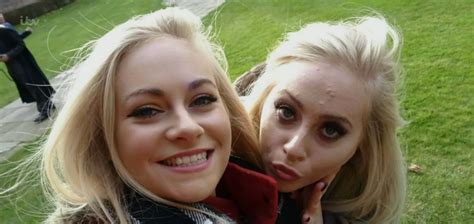 Who Are Plastic Surgery Twins Daisy And Dolly