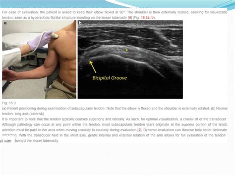 Shoulder Joint Usg Basics For Begginers Pptx