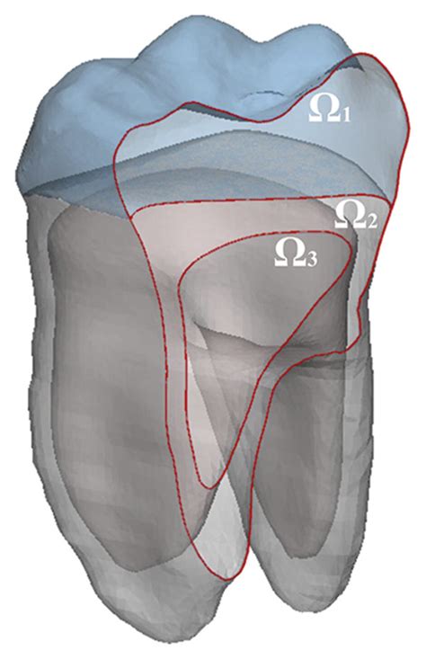 Bionic Multilevel Model Simulation Of Molar A Model Reconstruction