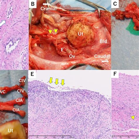 Macroscopic And Histopathological Findings In Case 2 A Macroscopic