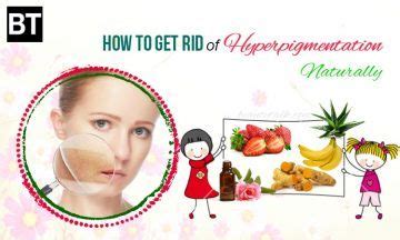 Ways How To Get Rid Of Hyperpigmentation Naturally