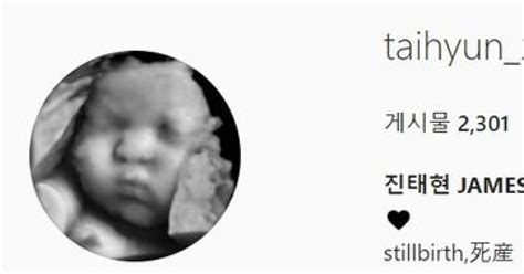 진태현 먹먹한 근황 Sns 프로필에 새긴 글자 사산 死産