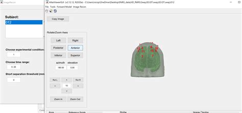 Atlasviewer Image Recon Issue Homer3 And Atlasviewer Openfnirs Forum