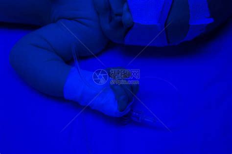 在医院治疗黄疸的新生儿光疗高清图片下载 正版图片505080100 摄图网