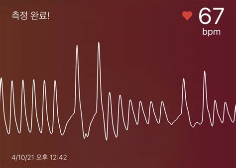 부정맥 있는 익들 있어 ㅠㅠㅠㅠㅠ 인스티즈 Instiz 일상 카테고리