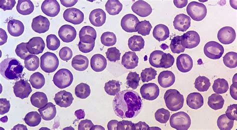 Les Chercheurs Ont Découvert Un Lien étrange Entre Le Virus De La