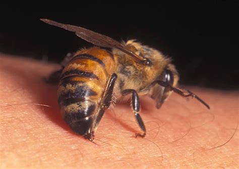 Bee Venom And The Chemistry Of Ouch Bee Culture