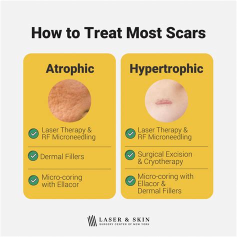 Laser And Skin Surgery Center Of New York Best Treatments For All Types
