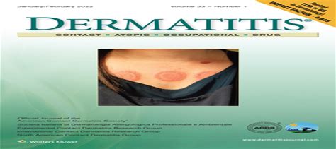 Patch Testing In Drug Eruptions Practical Aspects And Liter