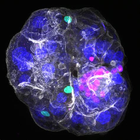肝臓構造を再構築するオールインワンモデルall In One Model Reconstructs Complex Liver