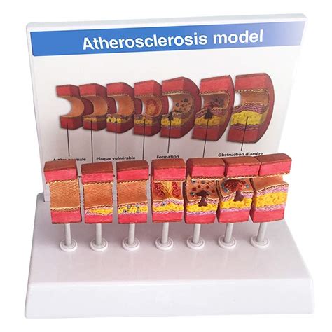 Buy Educational Model Artery Anatomical Model Anatomical Vessel