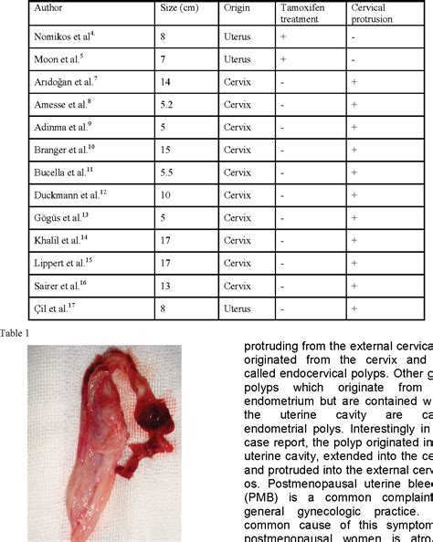 How Big Is A 2 Cm Uterine Polyp At Leo Brodbeck Blog