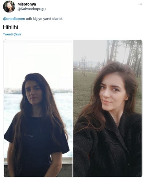 Burun Ameliyatı Olup Öncesi ve Sonrası Fotoğraflarını Paylaşırken