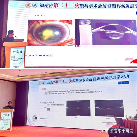 福州眼科医院专家团队在第二十二次福建省眼科学术大会上绽放光彩 知乎