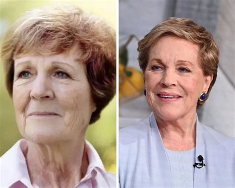 Julie Andrews Plastic Surgery Celebrities Cosmetic Surgery