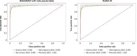 Figure 4 From Brain Tumour Detection From Magnetic Resonance Imaging Using Convolutional Neural