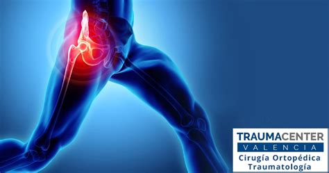 Dolor De Cadera Traumacenter Valencia