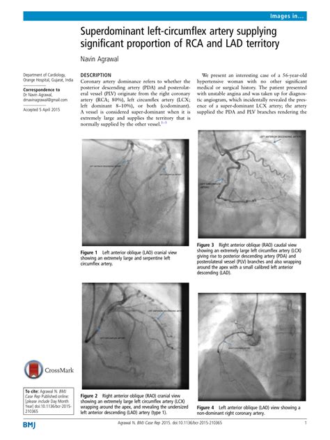 Pdf Superdominant Left Circumflex Artery Supplying Significant