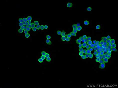 Cd45 Antibody 80297 1 Rr Proteintech