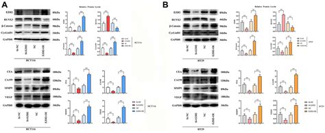 Down Regulation Of Ezh2 Genes Targeting Runx3 Affects Proliferation Invasion And Metastasis Of