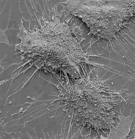 Bone Cancer Cells Sem Stock Image F0439933 Science Photo Library