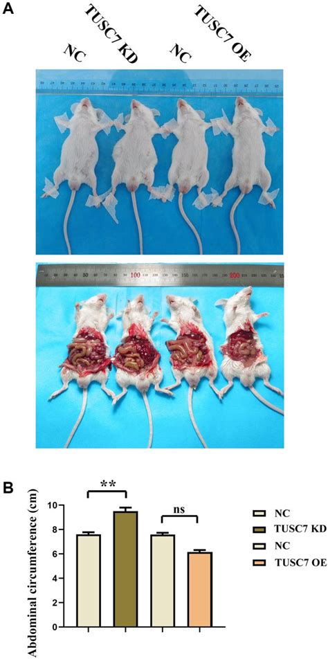 Figure 1 From Lncrna Tusc7 Regulates Oxidative Stress Level By