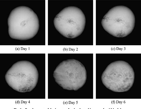 Figure 3 From An Adaptive Image Segmentation Algorithm For X Ray
