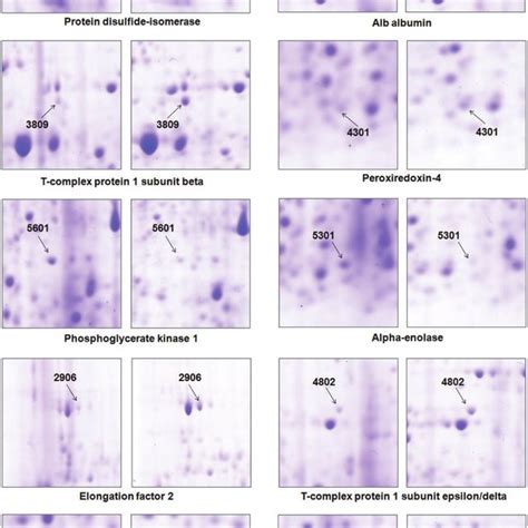 Segments Of Two Dimensional Electrophoresis Gel Maps Derived From
