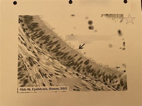 Epithelial Tissue On Light Micrograph Diagram Quizlet