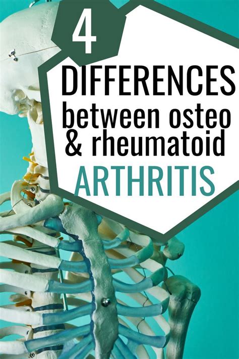 What Is The Difference Between Osteoarthritis And Rheumatoid Arthritis