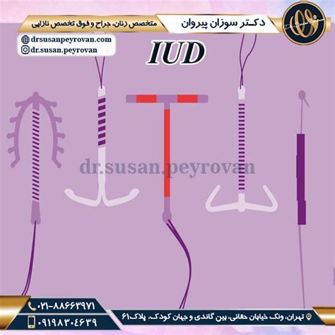 Iud ایمن ترین روش جلوگیری از بارداری دکتر سوزان پیروان