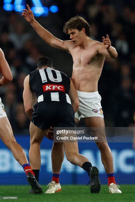 Deven Robertson Of The Lions Is Seen After Removing His Torn Guernsey