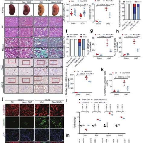 Neu1 Overexpression Aggravates Uuo Induced Renal Fibrosis Fig2
