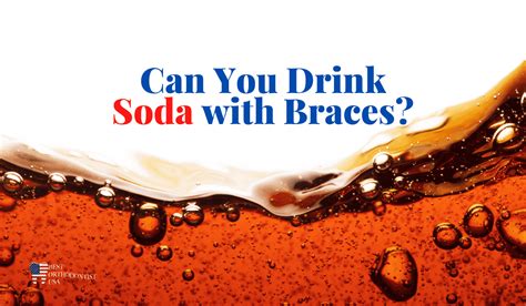 Can You Drink Soda With Braces 2023 Guide Best Orthodontist USA