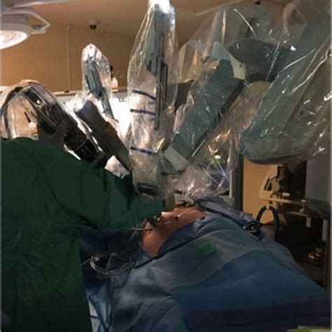 Single Incision Laparoscopic Donor Nephrectomy Port Placement A With Download Scientific