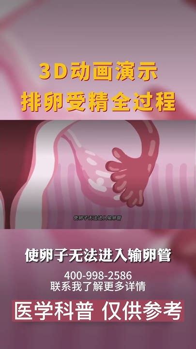 3d动画演示排卵受精全过程 试管婴儿 合法代孕爱优选 代孕国家 亚美尼亚合法代孕 代孕价格爱优选 中国 北京 上海 广州