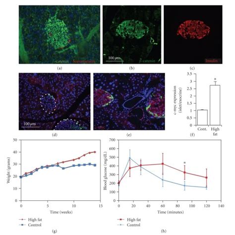 Wnt signaling in high fat fed mice In normal mouse pancreas β catenin