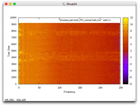 ECG HTM Devpost
