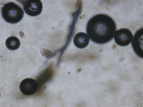 Trichostrongylus Retortaeformis Egg 03 In Rabbits Lapis Vetlexicon