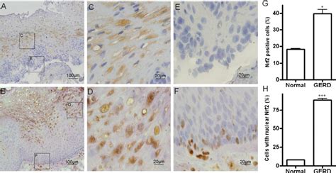 Expression Of Nrf2 In Human Biopsy Tissue Of Normal Oesophagus A C