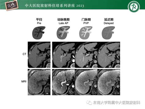 PPT 肝脏影像通用术语和图谱解读 影像PPT