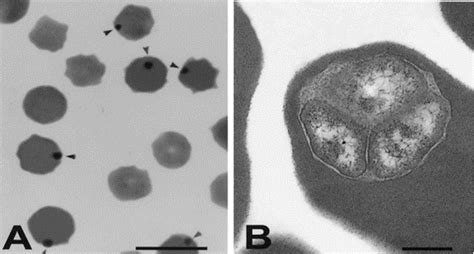Anaplasmosis Bovina Y Como Controlarla Agrovet Market Productos