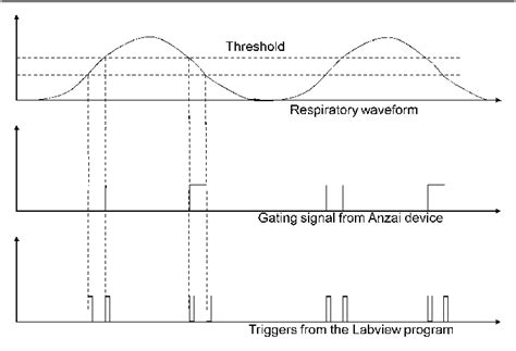 Relationship Between Respiratory Waveform And Triggers Generated From