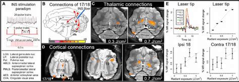 Global Connections Revealed By Ins Stimulation In Cat Visual Cortex Download Scientific
