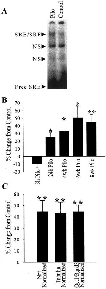SRF Protein Expression Is Upregulated By SE Representative Western