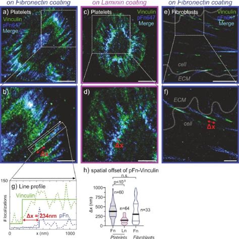 Fibronectin Extracellular Matrix Assembled By Human Platelets Seeded On