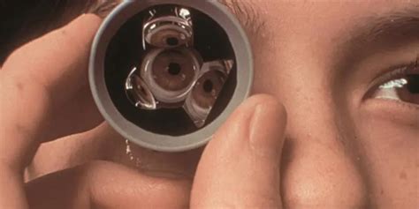 What Is Gonioscopy American Academy Of Ophthalmology