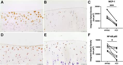 Mcp 1 And Nf Kb P65 Immunohistochemistry Of Medial Tibia Plateau Mtp