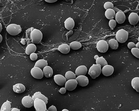 科学网—真菌制造“化学武器”对抗同类